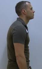 Posture Problems – Physio Dublin – Laurel Lodge Physiotherapy, Dublin ...